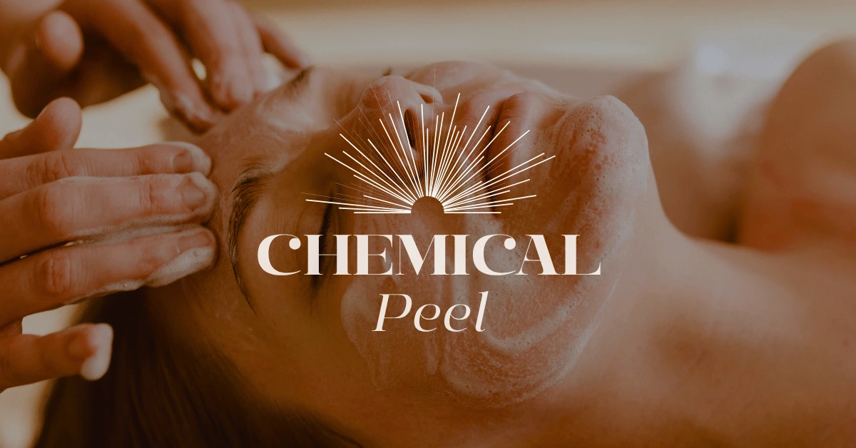 Chemical Peel in Kilcullen, near Naas ⁕ By Marta Czarnecka